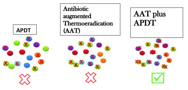 Antimicrobial Photodynamic Therapy (APDT): A New Therapeutic Option to ...